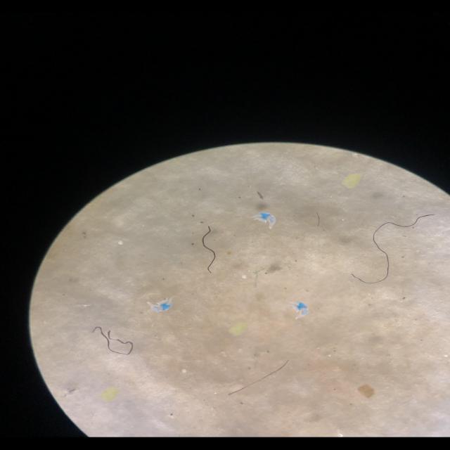 Microplastics Detection Sediment Object Detection Model By Hina