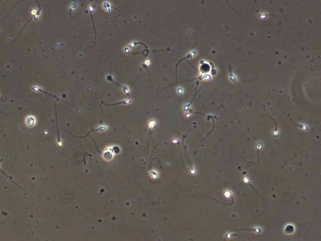 Sperm Detection VISEM Object Detection Model by Kate Nguyen