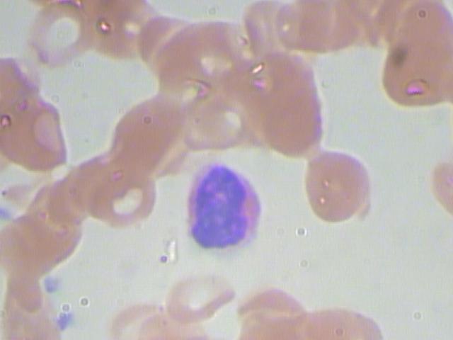 Blood Cells Object Detection Dataset and Pre-Trained Model by ...