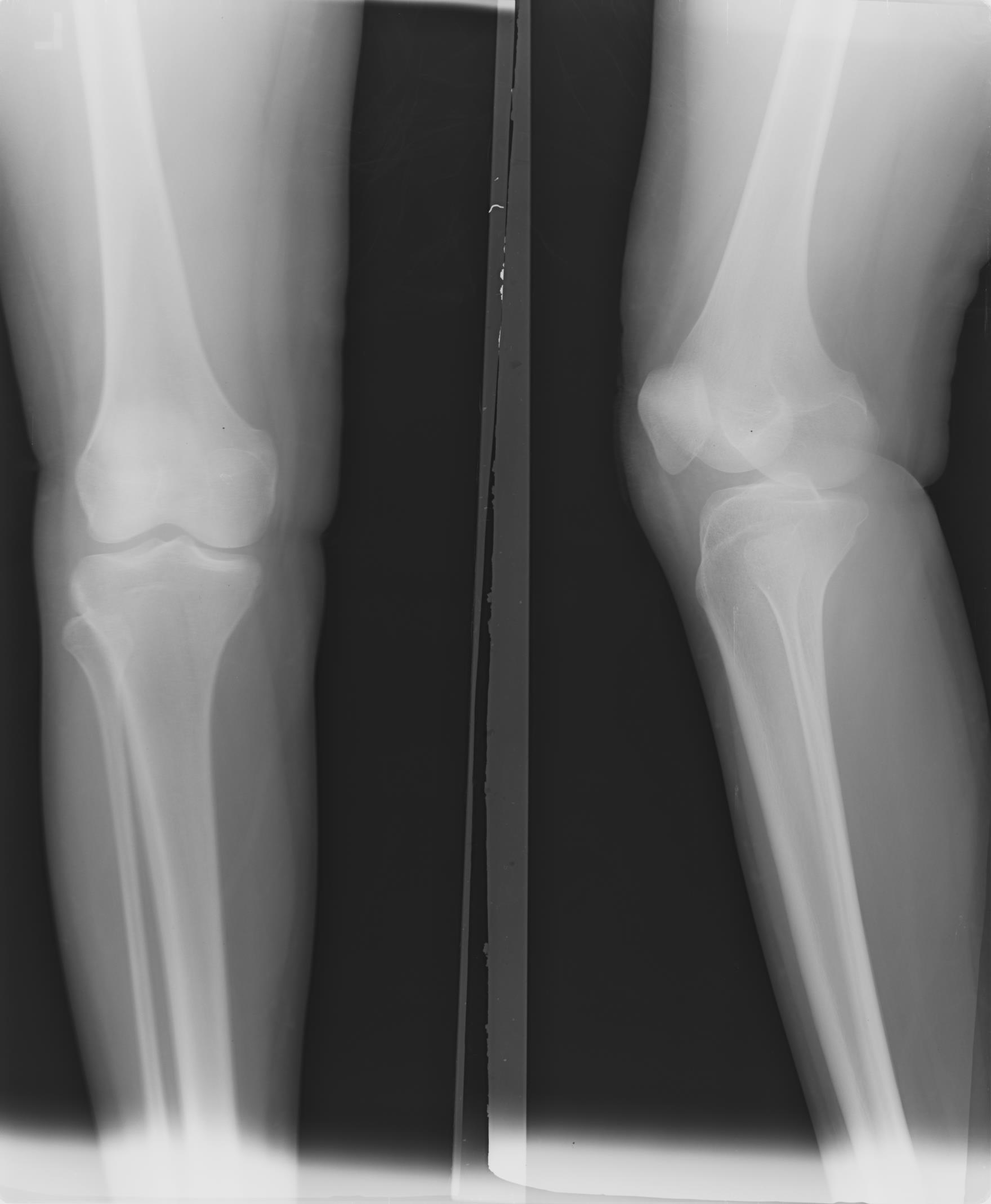 Radiology extraction Object Detection Dataset and Pre-Trained Model by mansoura college academy