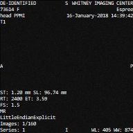 mllab (mllab-czvlh) - Roboflow Universe
