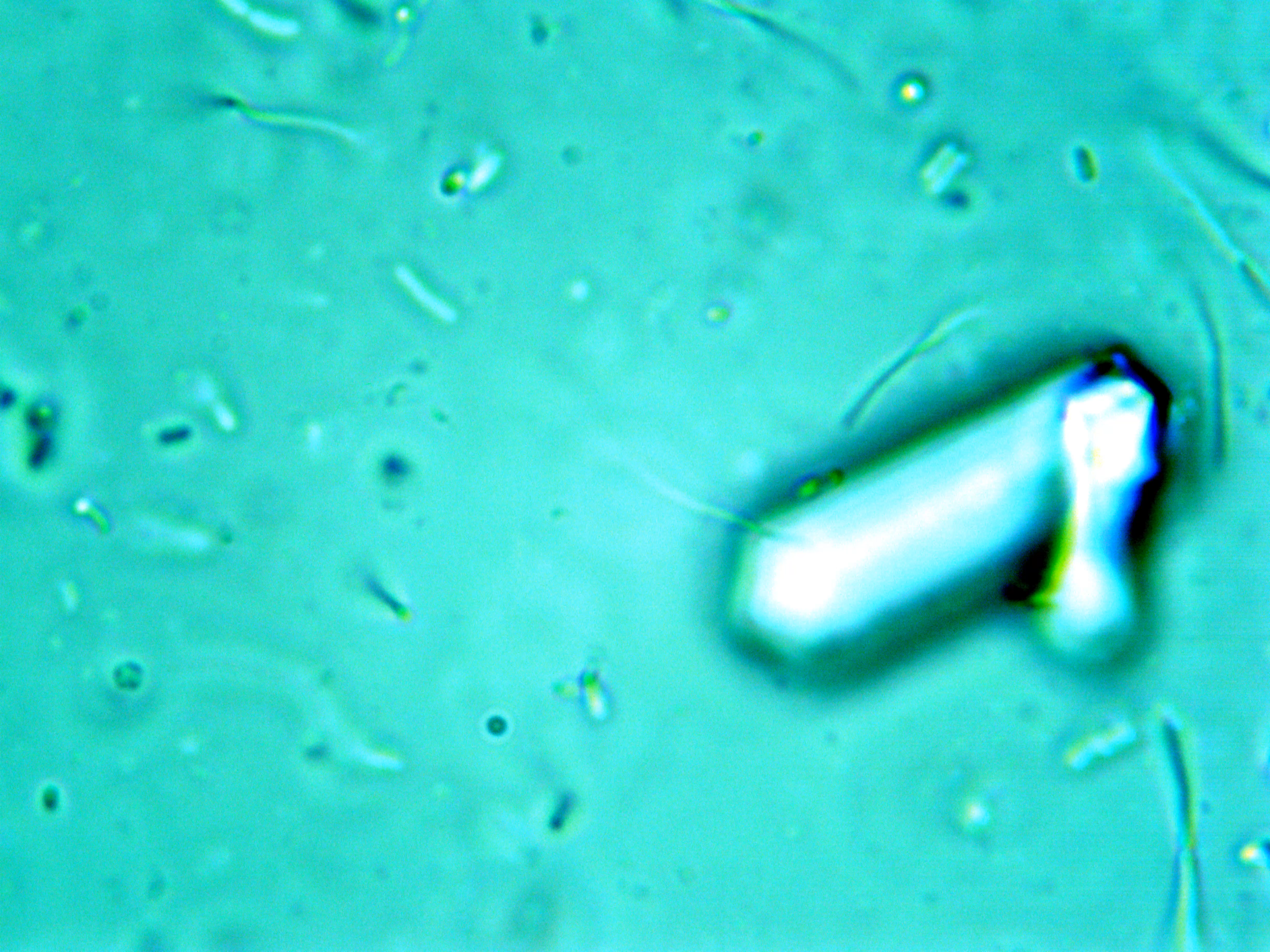 Bacteria State Prediction Instance Segmentation Dataset by aimen