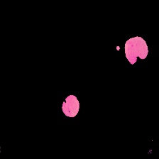 Lukemia Object Detection Dataset and Pre-Trained Model by scanobject