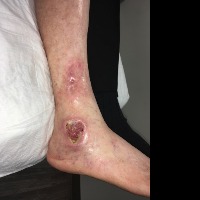 like:cv-pyvkz/fetal-brain-instance-segmentation-hfm4q | Roboflow ...