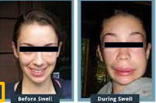 Cyclegan Demo Object Detection Model By Enthreads