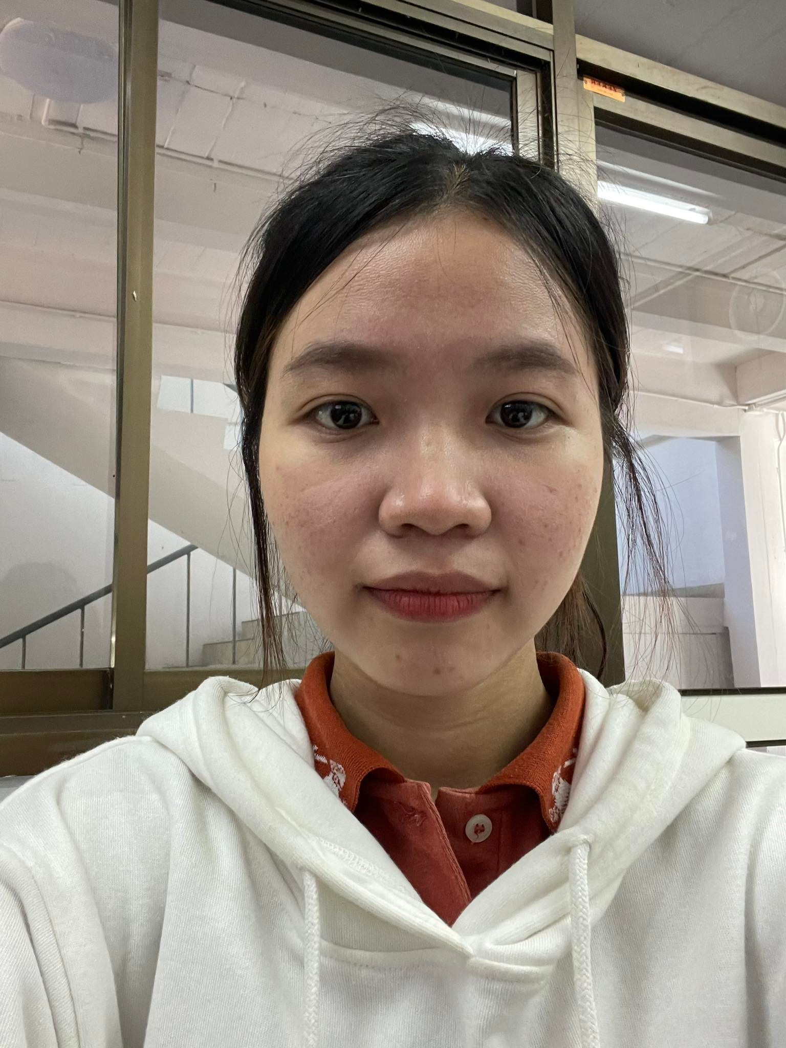 SP2 Object Detection Model by puripongroboflow