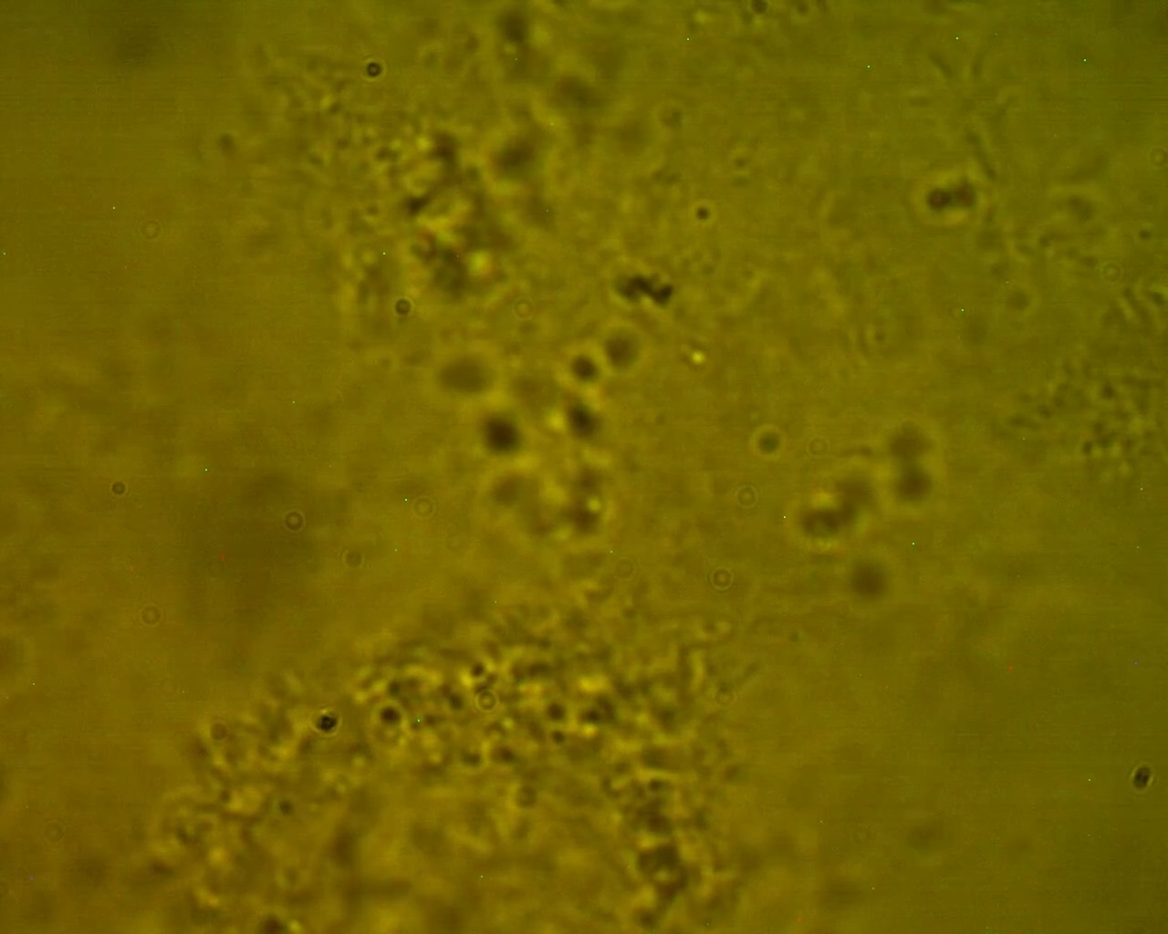 Detection1 Object Detection Dataset By From Roboflow Import Roboflow Rf Roboflowapikeyyourapikey