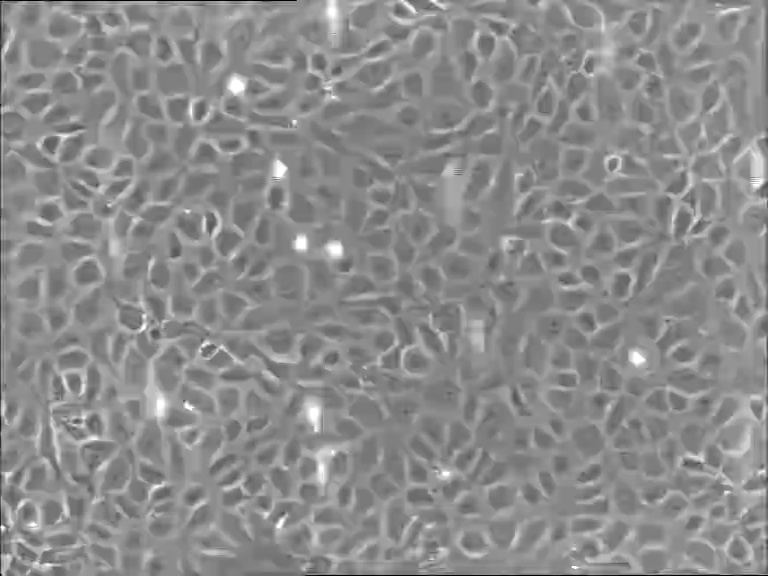 Cancer Cell Tracker Object Detection Model by cancercelldet