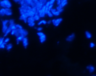 detectron2_augmentation Instance Segmentation Dataset and Pre-Trained Model by detectron2