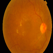 Eye Object Detection Dataset by Gulalai Zafar