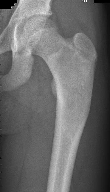 tumor Object Detection Dataset by eastwind