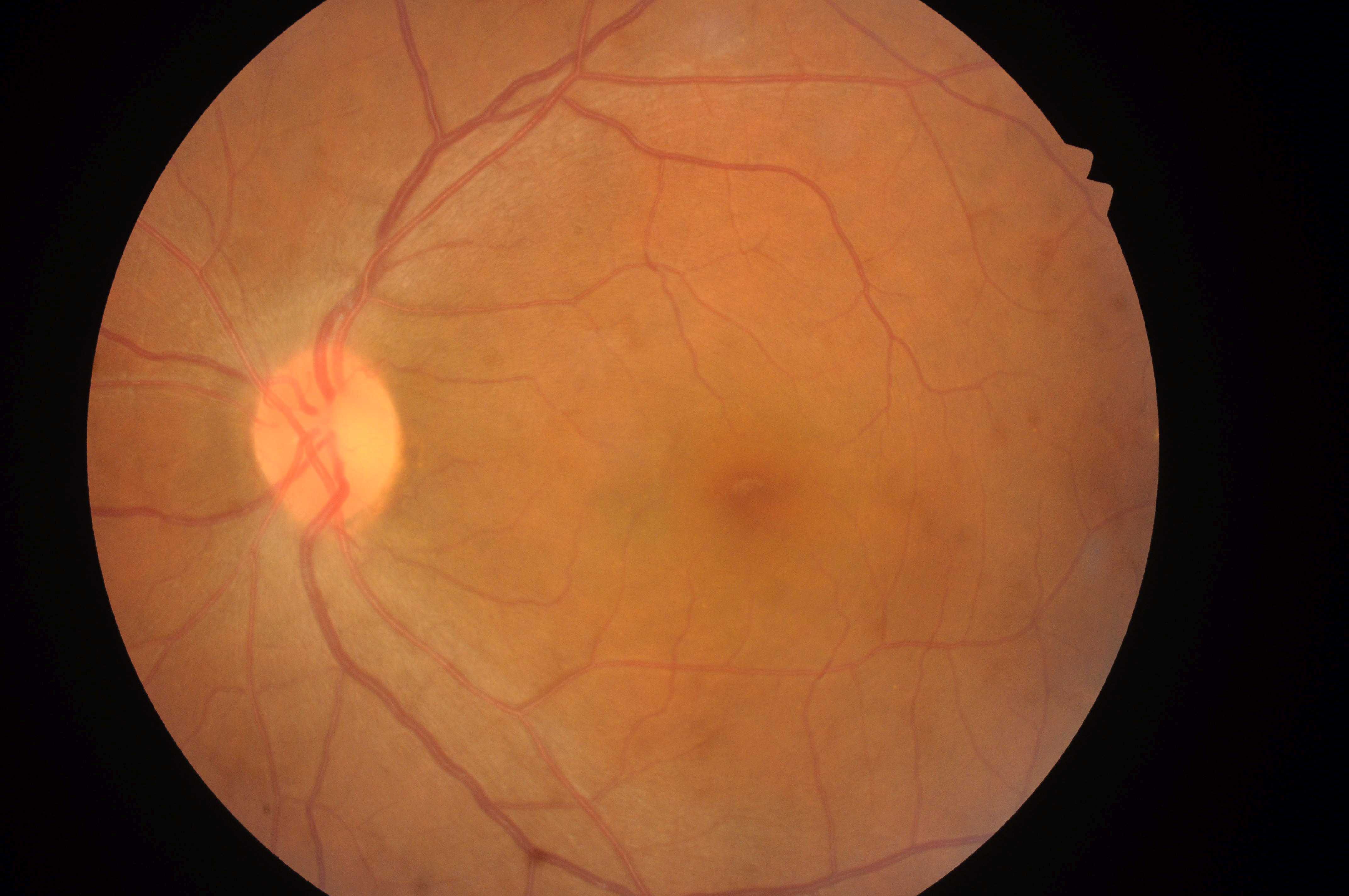 beyda (beyda-xdpaz) - Roboflow Universe