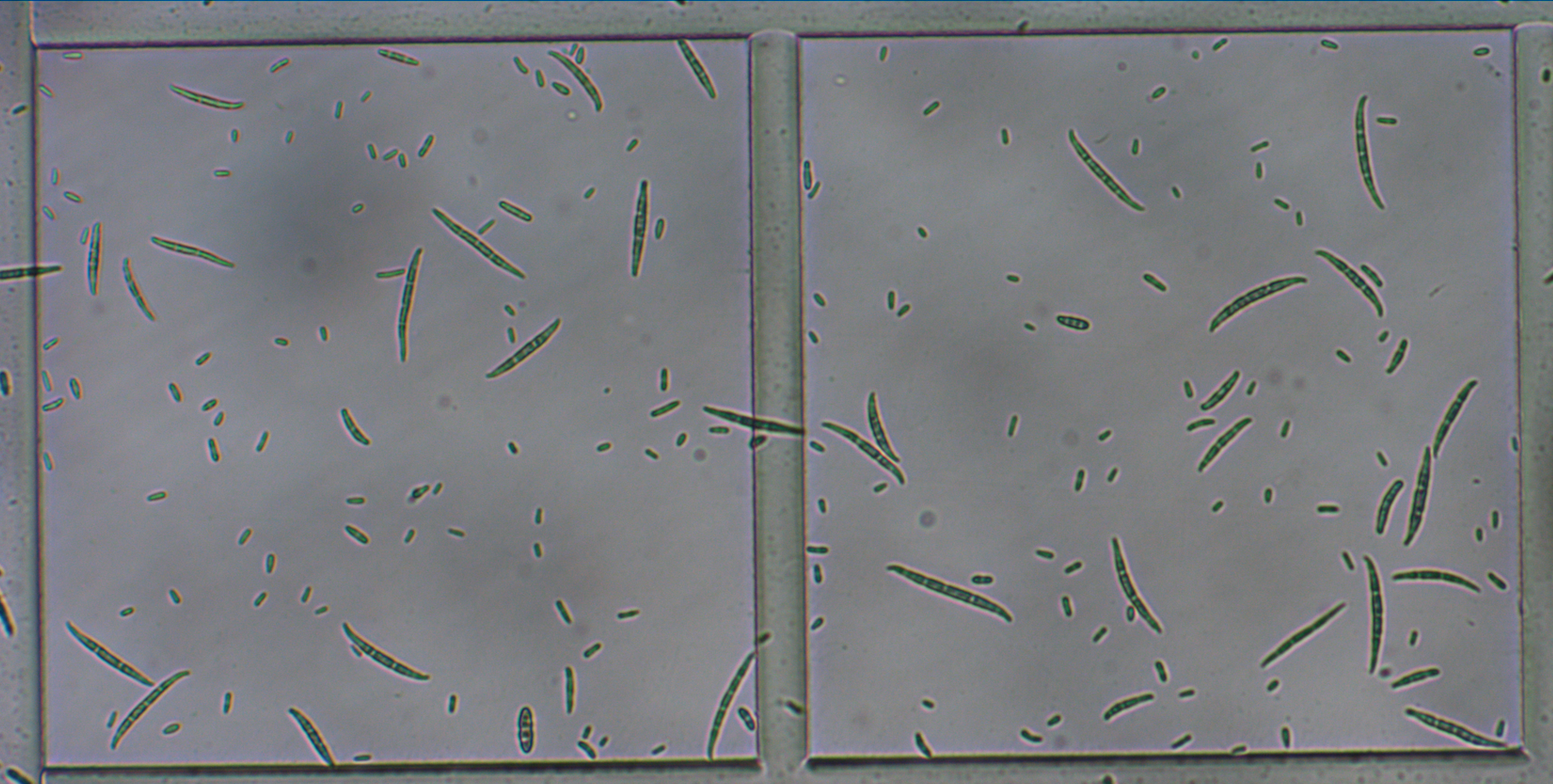 Curvularia genus Instance Segmentation Model by Conidia