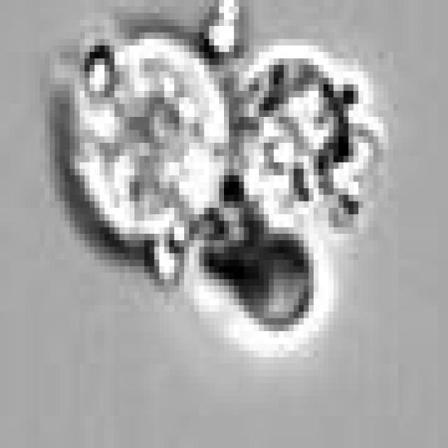 Cancer cell-box Object Detection Dataset by datasetattendance