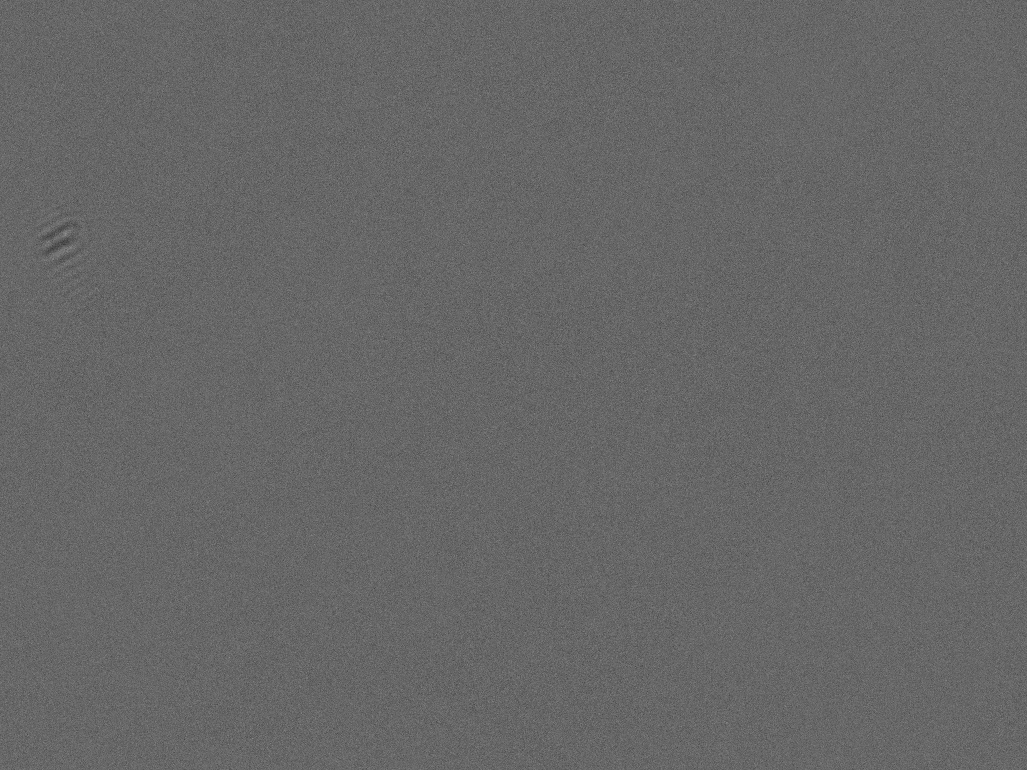 PD Fluid Detection Object Detection Dataset by Labeling Data