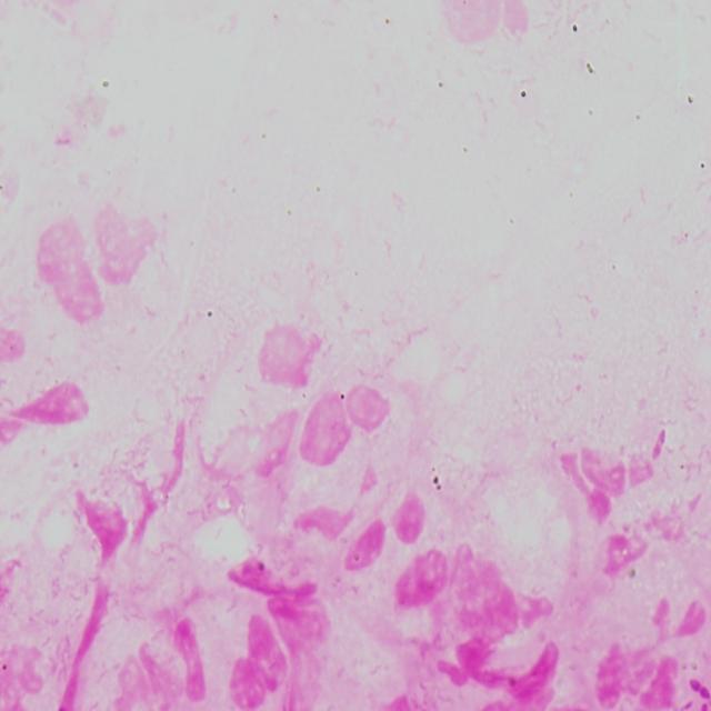 campylo Object Detection Dataset by class