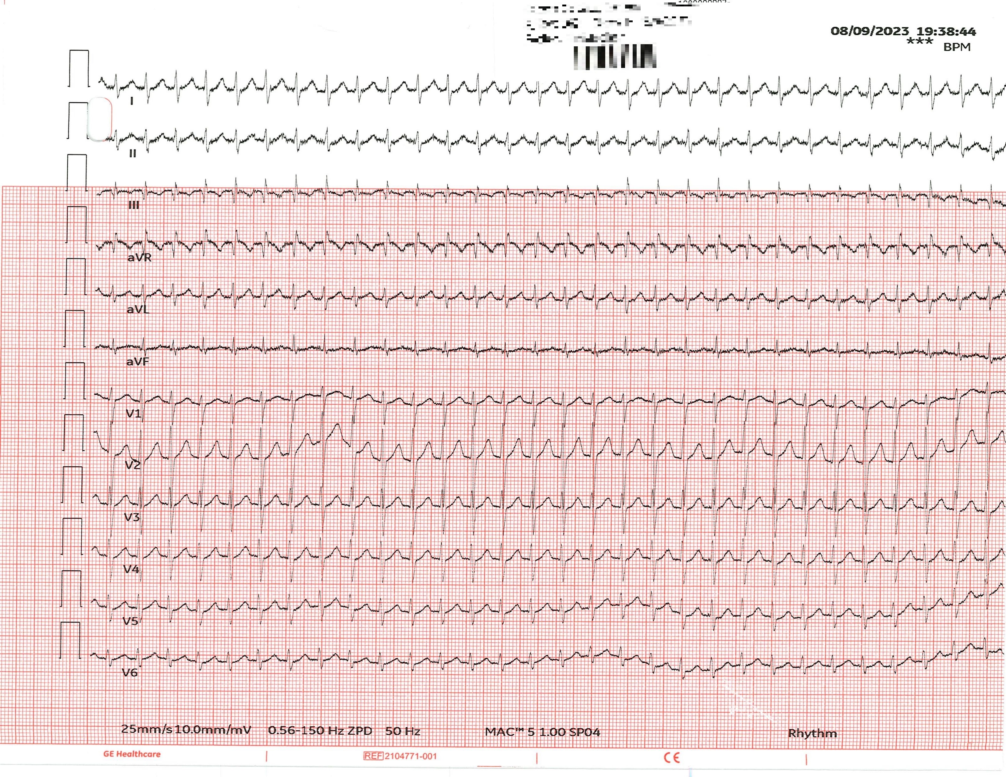 EKG_table Object Detection Model by test