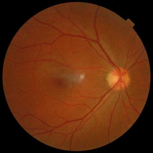 dia Object Detection Dataset and Pre-Trained Model by retino