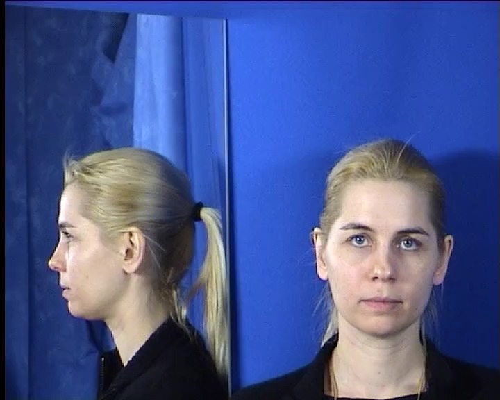 Emotions Detection Object Detection Dataset By Acne Detection