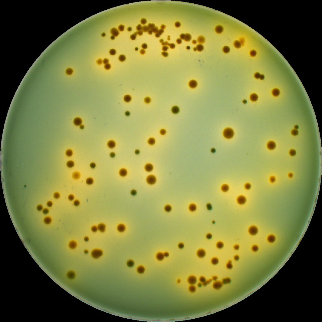 Colony Instance Segmentation Dataset by Test Project